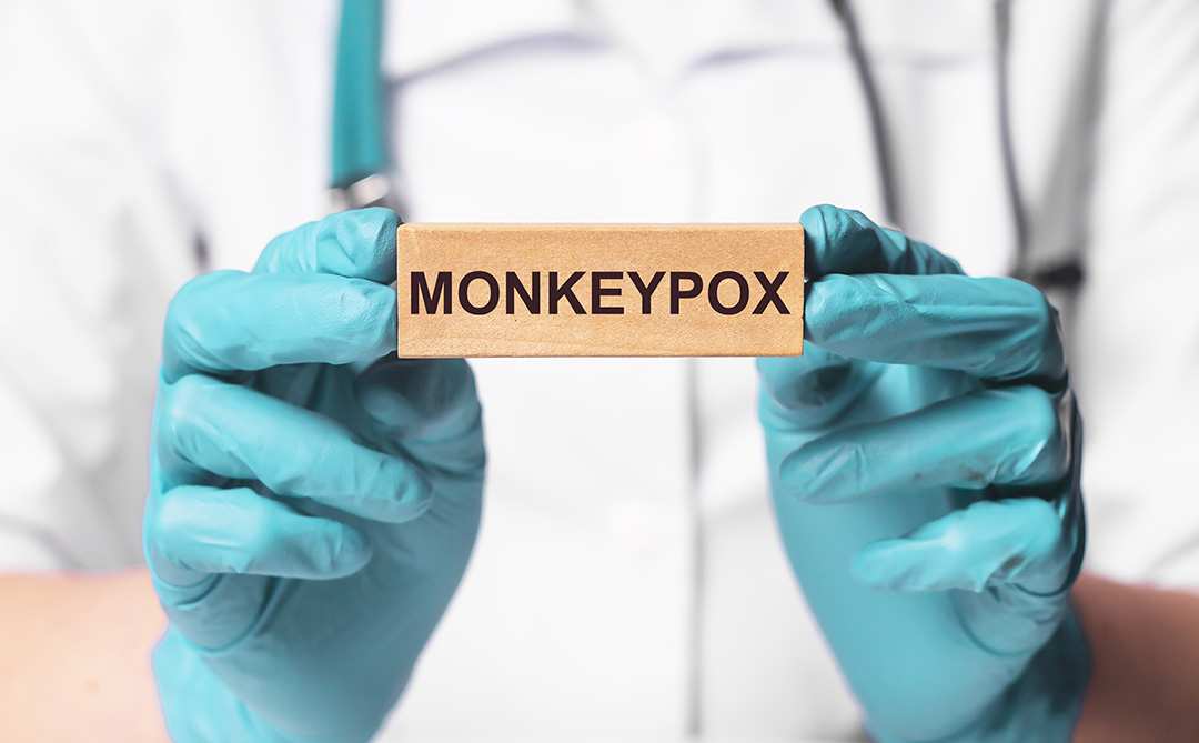 What You Need To Know About Monkeypox